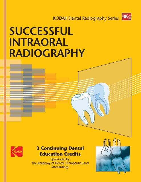 SUCCESSFUL INTRAORAL RADIOGRAPHY - Carestream Dental
