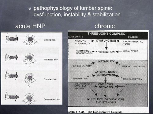 pathophysiology of lumbar