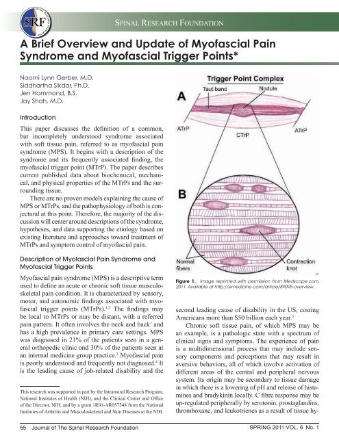 A Brief Overview and Update of Myofascial Pain Syndrome and ...
