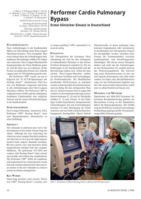Performer Cardio Pulmonary Bypass