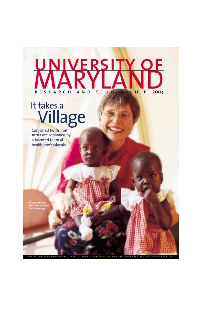 surgery to separate conjoined twins - Bruce Goldfarb