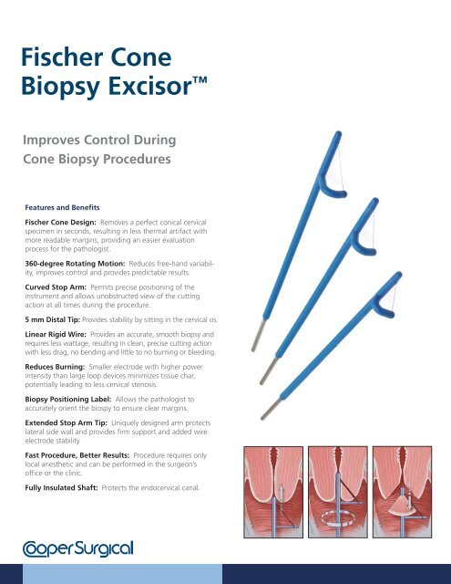 Fischer Cone Biopsy Excisor - CooperSurgical