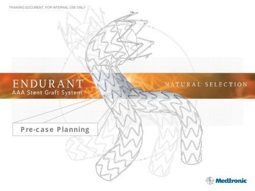 Medtronic Endurant Precase Planning Final - Evar Education