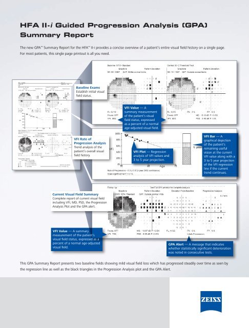 (GPA) Summary Report - Carl Zeiss Meditec AG