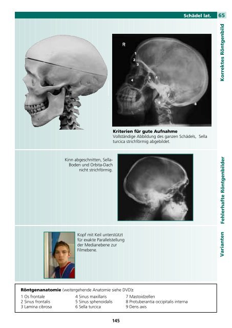 65 Schädel lat. (sitzend