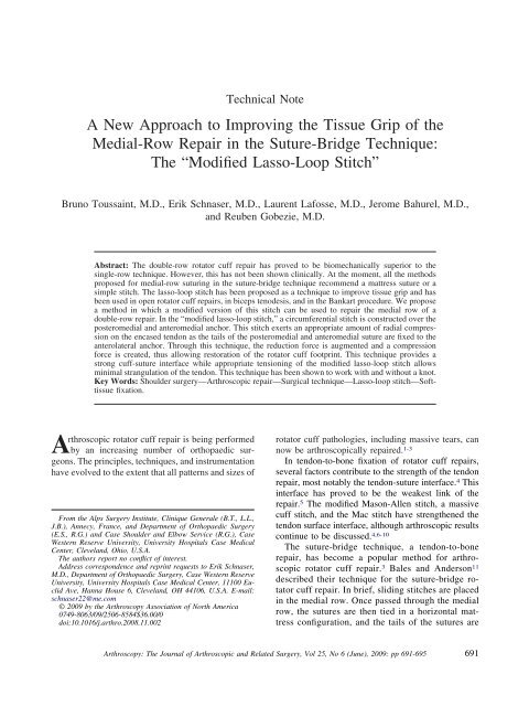 Modified Lasso-Loop Stitch - Arthroscopic Total Shoulder ...