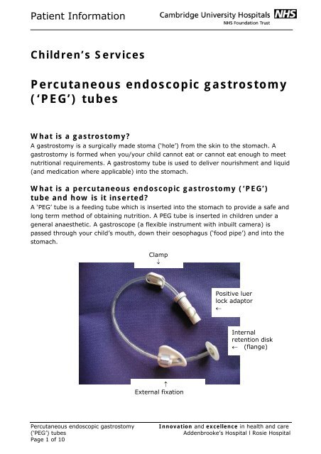 Percutaneous endoscopic gastrostomy ('PEG') tubes - Cambridge ...