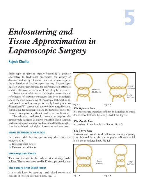 endosuturing and tissue Approximation in Laparoscopic ... - IAGES