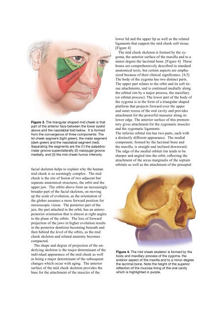upper horizontal line abo