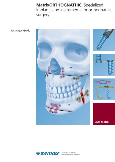 MatrixORTHOGNATHIC. Specialized implants and instruments for ...