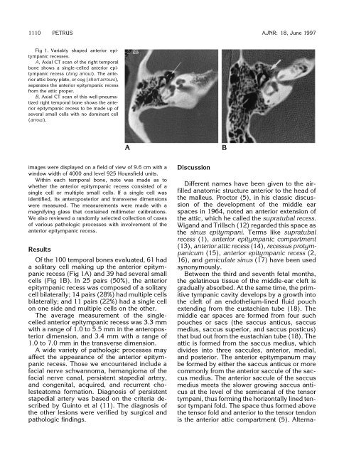 1110 PETRUS AJNR: 18, Jun