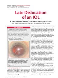 Iris-Sutured PCIOLs - Cataract & Refractive Surgery Today