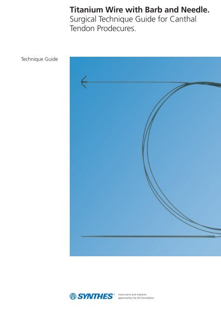 Titanium Wire with Barb and Needle. Surgical Technique ... - Synthes