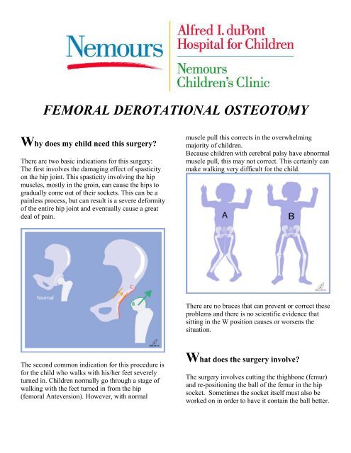 FEMORAL DEROTATIONAL OSTEOTOMY