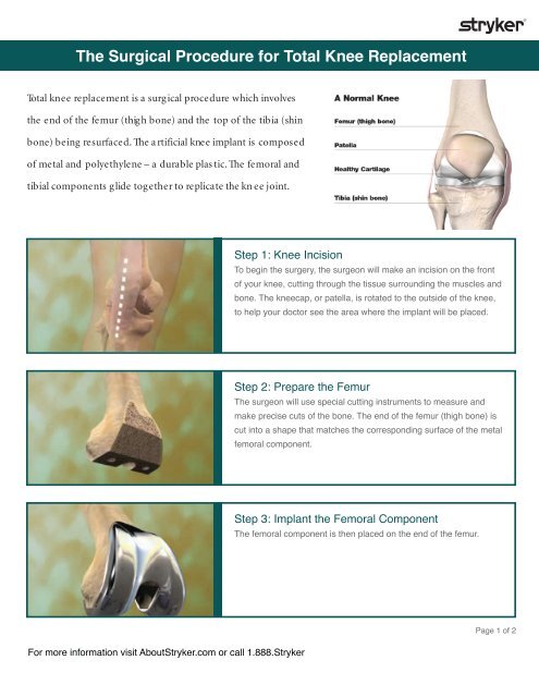 The Surgical Procedure for Total Knee Replacement - Stryker