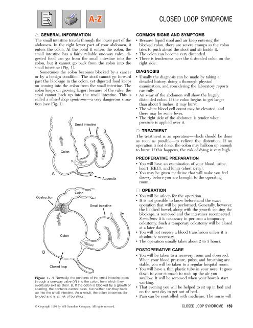 CLOSED LOOP SYNDROME - The Hutchinson Clinic
