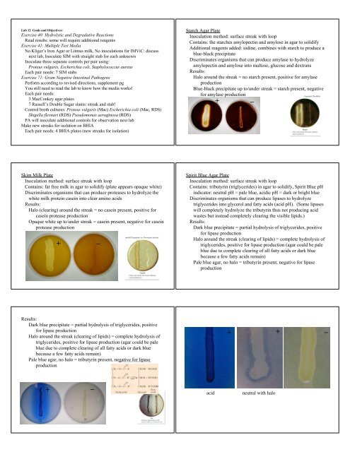 Starch Agar Plate Inoculation method: surface streak with loop ...
