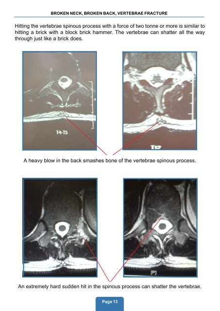 BROKEN NECK, BROKEN BACK,