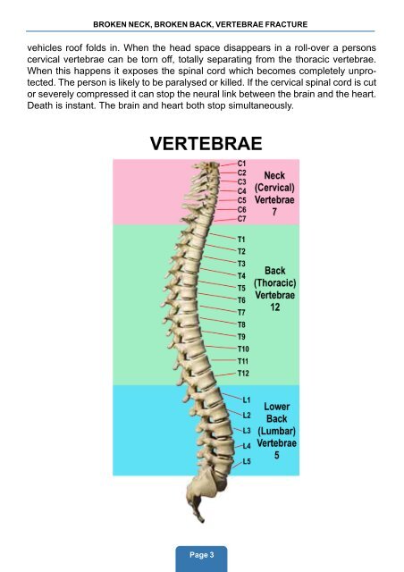 BROKEN NECK, BROKEN BACK,