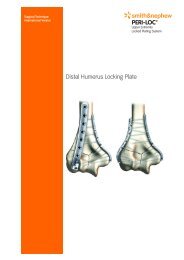 Exeter trauma stem hip hemiarthroplasty