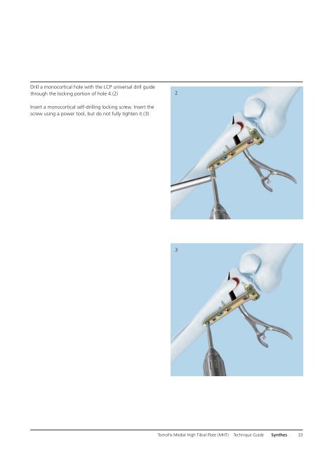 Positioning and Fixation