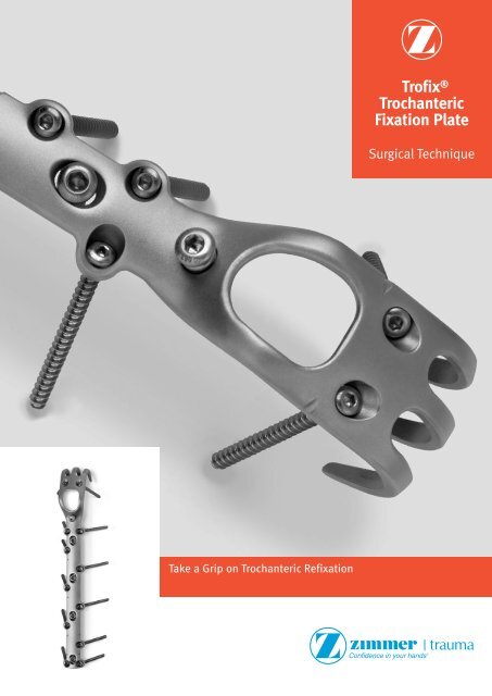 Trofix® Trochanteric Fixation Plate - zimmer2.eu