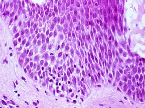 Spongiotic Dermatitis- Can We Be More Specific?