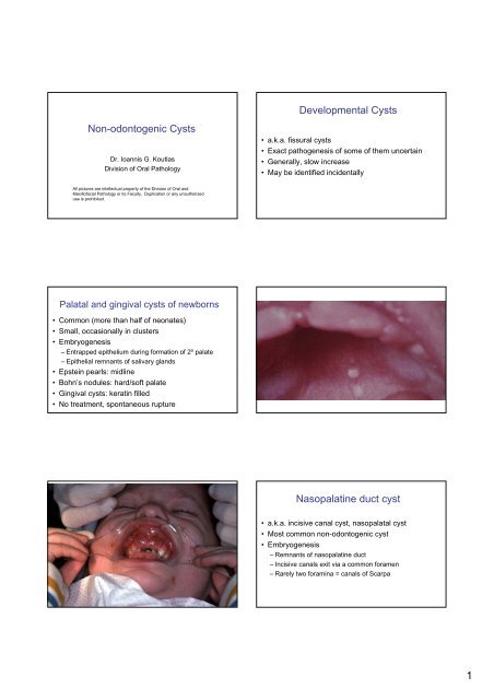 Non-odontogenic Cysts Developmental Cysts Nasopalatine duct cyst