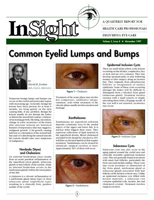 Common Eyelid Lumps and Bumps - Dr. David R. Jordan
