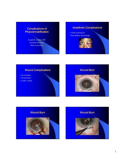 Complications Of Phacoemulsification Anesthetic Complications
