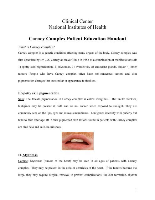 Carney Syndrome Tumors