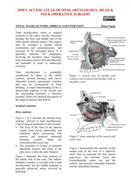 Lacrimal Hamulus