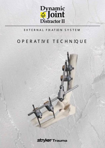 Dynamic Joint Distractor II External Fixation System - Stryker