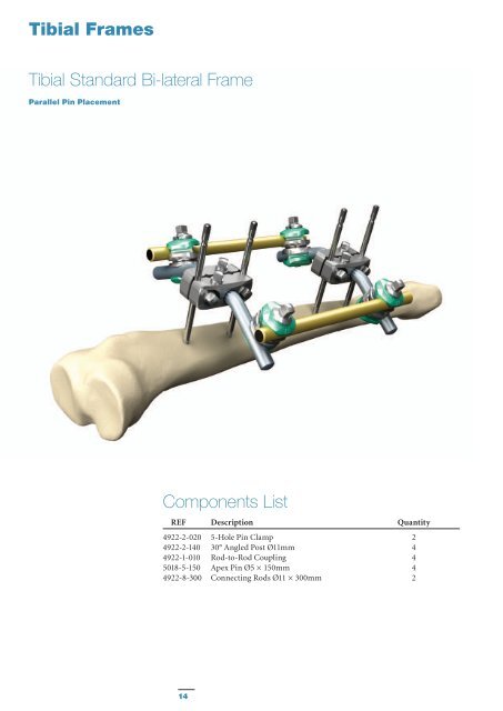 Tibial Frames Tibial Stan
