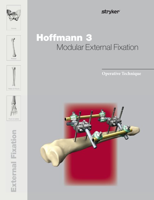 Hoffmann 3 Operative Technique - Stryker