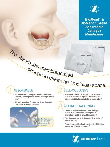 Collagen membranes - gt medical