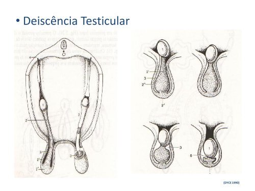 Deiscência Testicula