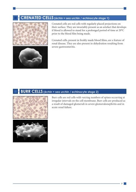 CRENATED CELLS (échin