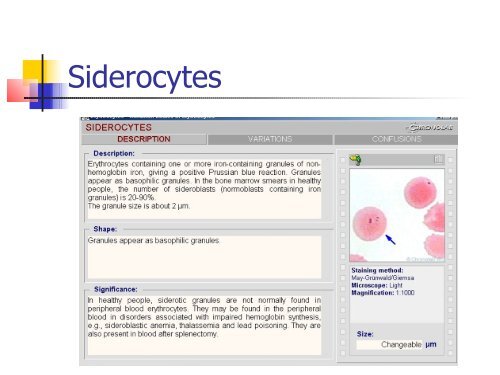 Siderocytes
