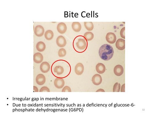 Bite Cells • Irregular