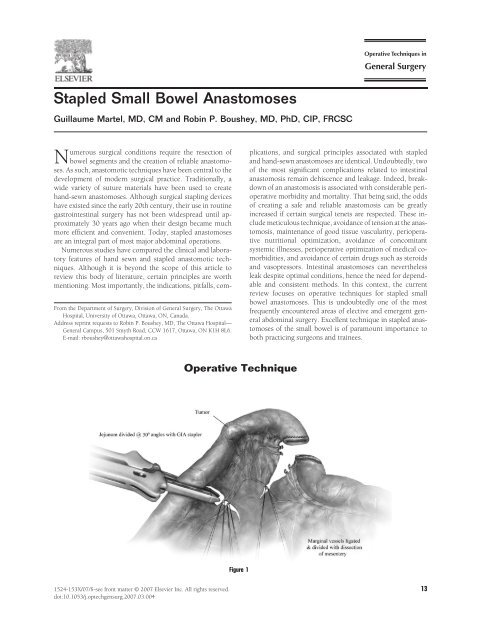 Stapled Small Bowel Anastomoses - Mydoctor.ca
