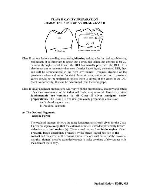 Class II Prep Handout