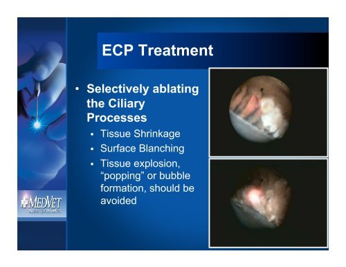 ECP Treatment • Selecti