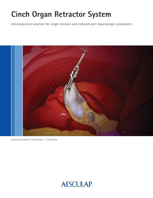 Cinch Organ Retractor System - Aesculap