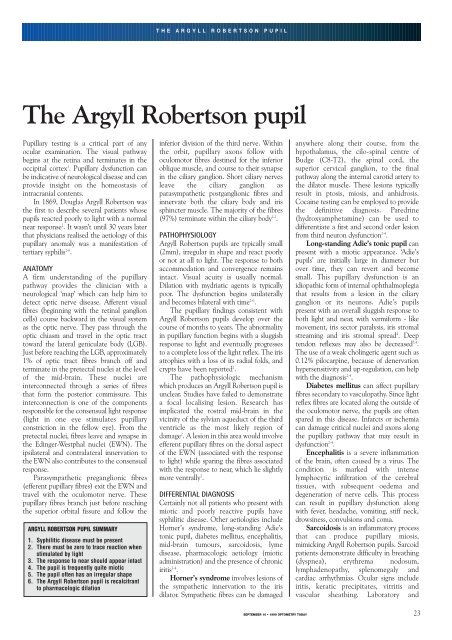 The Argyll Robertson pupil - Optometry Today