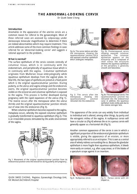 Cervical Os During Menses
