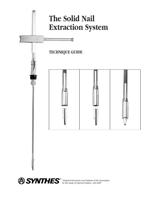 Solid Nail Extraction System Technique Guide - Osteosyntese