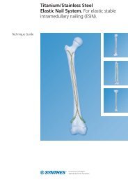 Collinear Reduction Clamp - Synthes