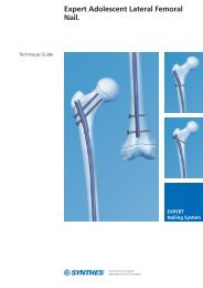 Expert HAN. Expert Hindfoot Arthrodesis Nail. - Synthes