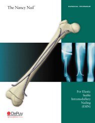 MBT Revision Tray Surgical Technique (DePuy) - PEI